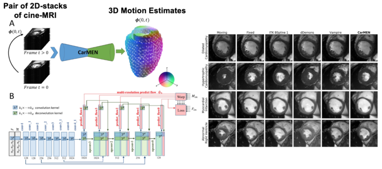 Motion correction – Catana Lab
