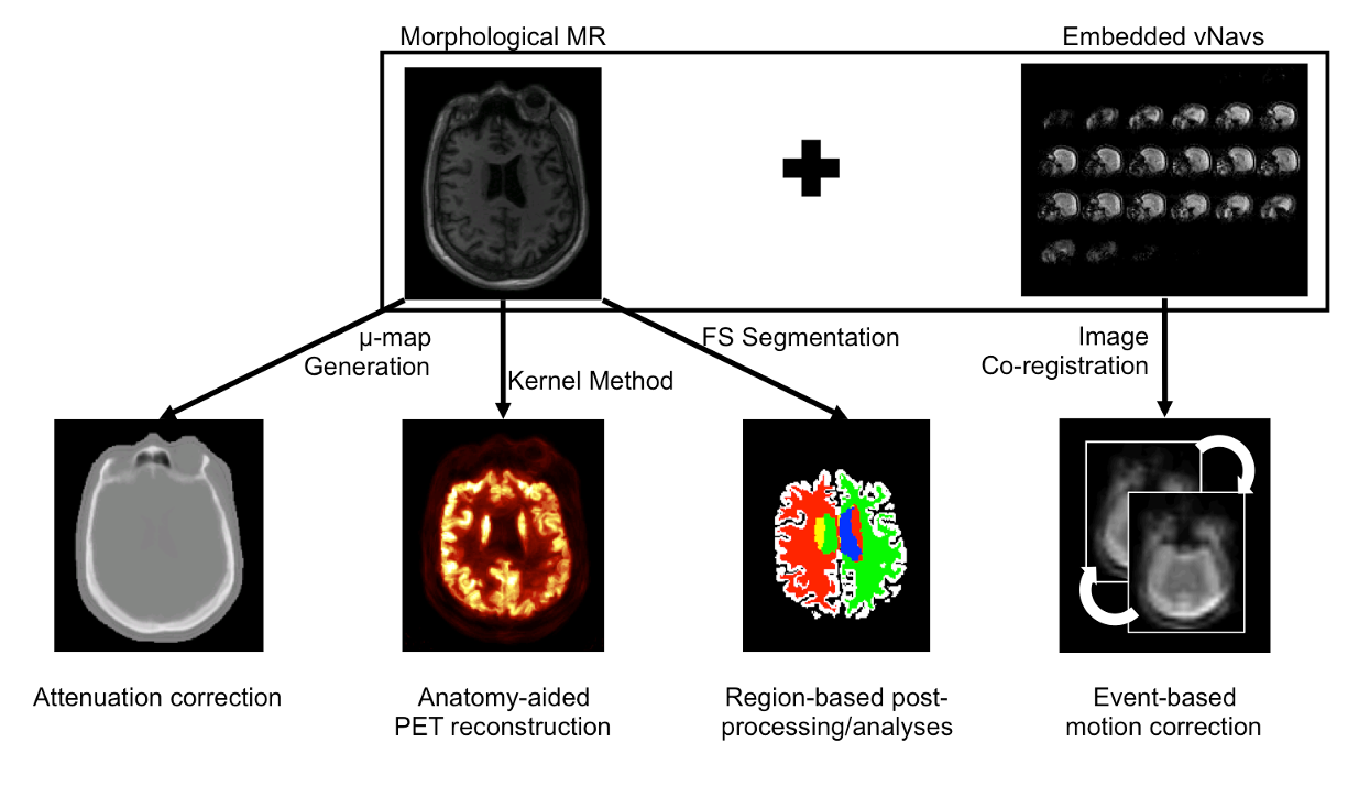 Image enhancement – Catana Lab
